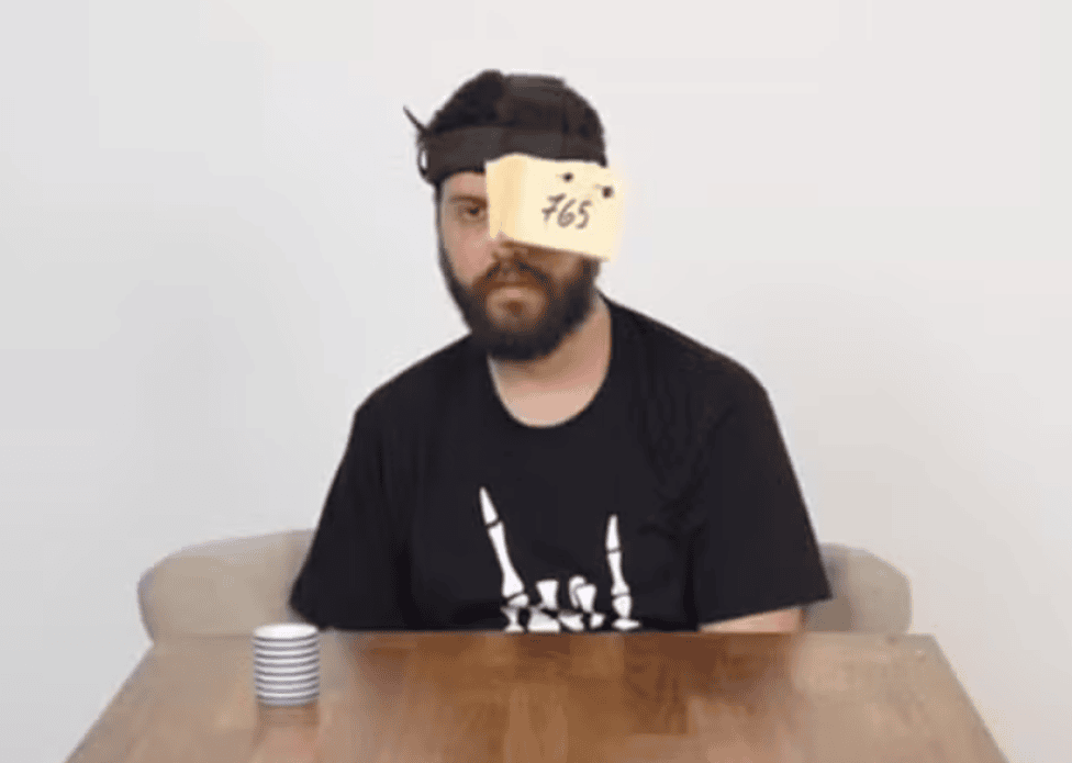 Diogo Defante mostra ‘novo olho’ após cirurgia; veja vídeo